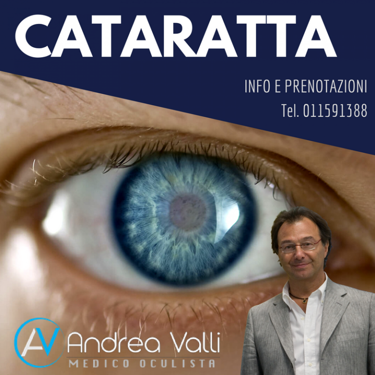 Operazione cataratta Torino. Dr. Andrea Valli